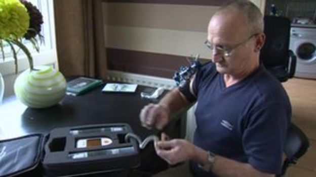 Man breaks arm again after waiting six years for recovery - BBC News