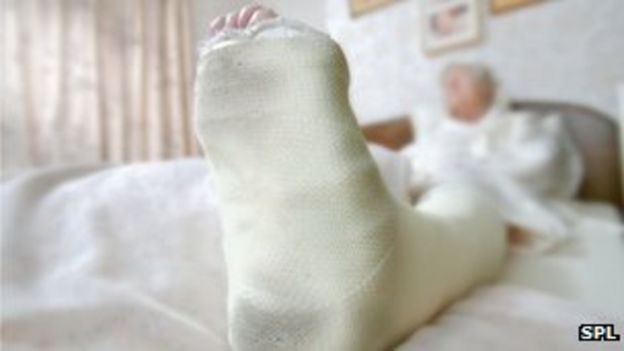 NICE says NHS must curb hospital falls - BBC News