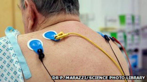 EU heart deaths 'halved since 1980s' - BBC News