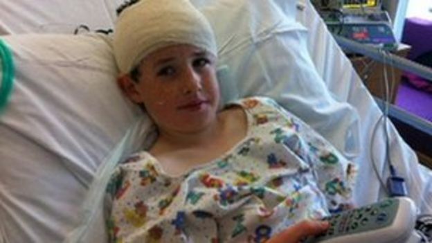 Oliver Kirk has ceramic skull implant at John Radcliffe Hospital - BBC News