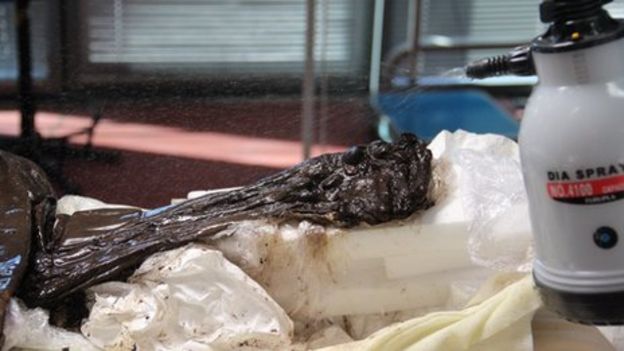 World's oldest bog body hints at violent past - BBC News