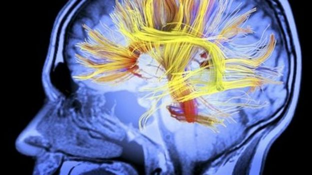 Cambridge and Antwerp scientists study brain damage treatment - BBC News