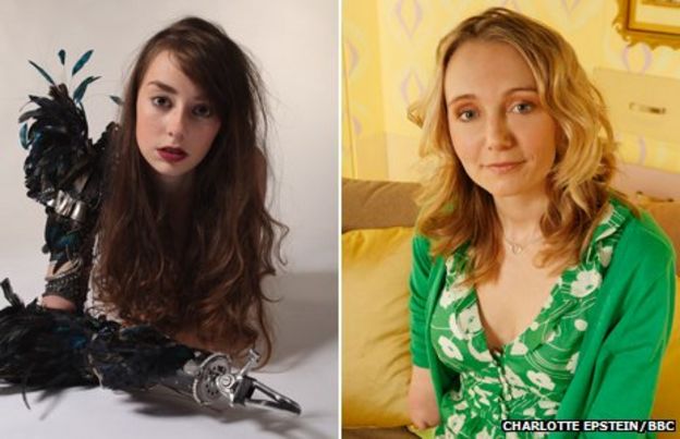 Life with one hand, and the week's other disability stories - BBC News