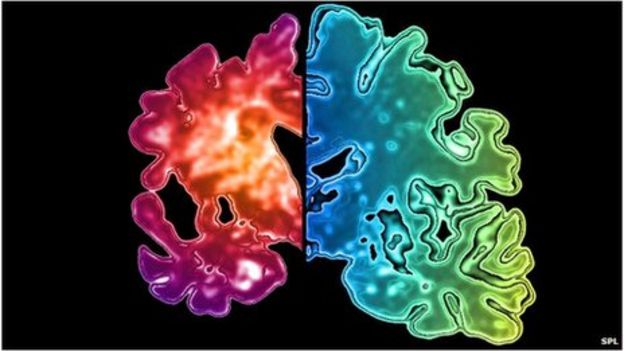 Angelina's mastectomy... and other medical stories of 2013 - BBC News