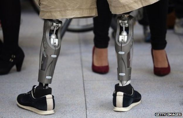 The hidden burden of war injuries and other stories - BBC News