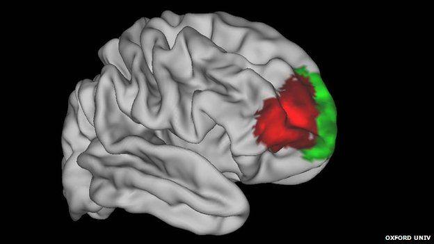 Why Oxford scientists are experimenting on monkeys - BBC News