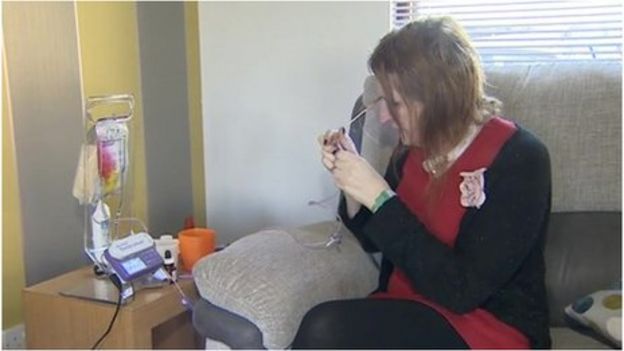 Stag gore victim Kate Stone able to eat after four months - BBC News