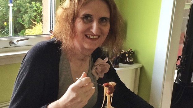 Stag gore victim Dr Kate Stone returns to Scottish Highlands - BBC News