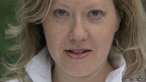 Inconvenient people: A Victorian view of mental-health treatment - BBC News