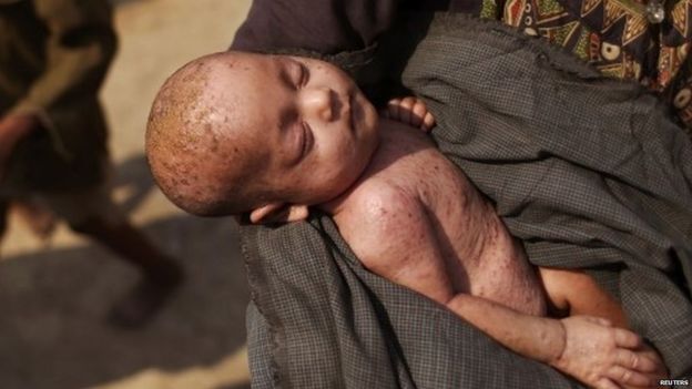 In pictures: Desperate plight of Muslims in Myanmar camp - BBC News
