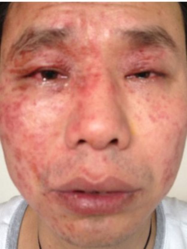 Cambridge drain explosion restaurant Lucky Star fined - BBC News