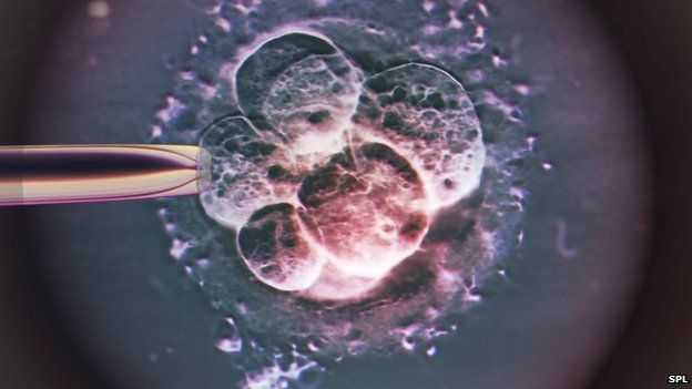 Why make babies from three people? - BBC News