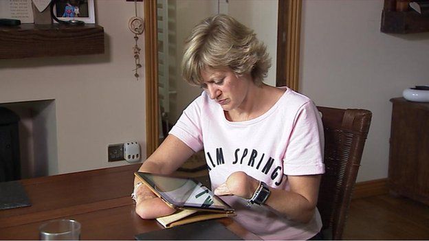 Scots woman to be first in UK to have double hand transplant - BBC News