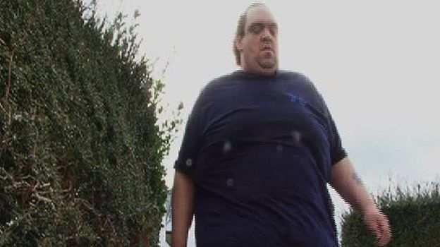 Expert denies claim obesity treatment in Wales is improving - BBC News
