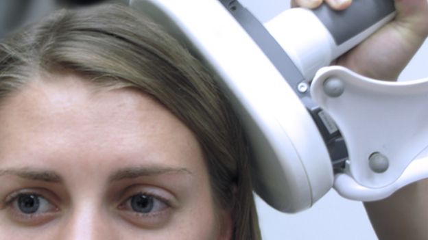 Electrical brain stimulation 'boosts memory' - BBC News