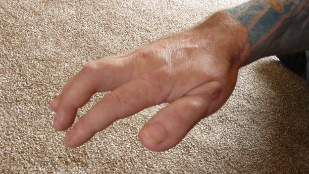 Man has hand reattached after 'horrific' machine accident - BBC News