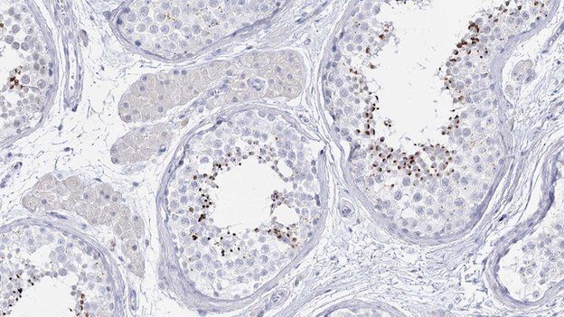 Testes 'most distinct human tissue' - BBC News