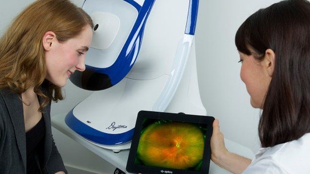 Optos agrees £259m takeover by Nikon - BBC News