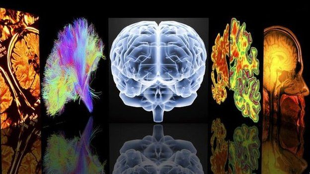 Dementia patients lack proper care, says report - BBC News