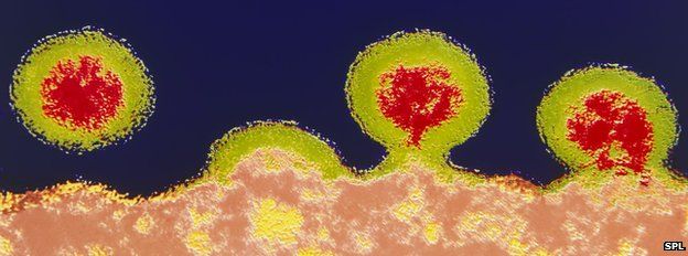 HIV: Why is the virus so 'successful'? - BBC News