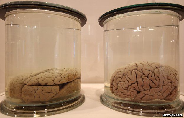 'Missing' brains at Texas university were destroyed - BBC News