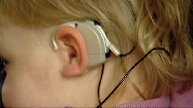 Locating objects using echoes 'needs two good ears' - BBC News