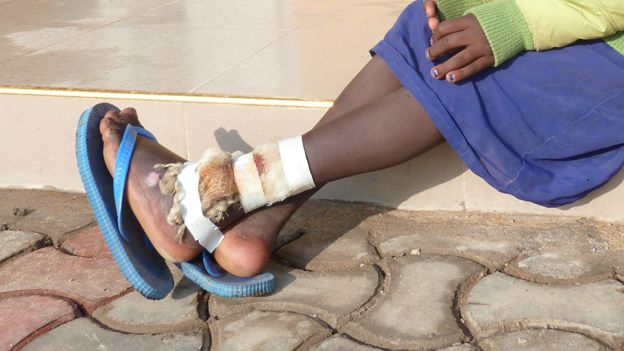 Saving girls from the 'cutting season' - BBC News