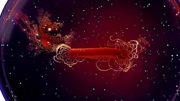 Ted 2015: Bacteria programmed to find tumours - BBC News