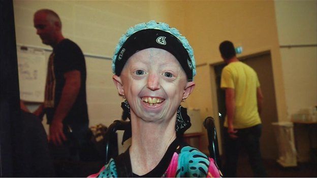 Hayley Okines: Bexhill funeral for progeria campaigner - BBC News