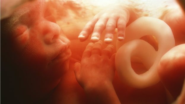 Dawn of gene-editing medicine? - BBC News