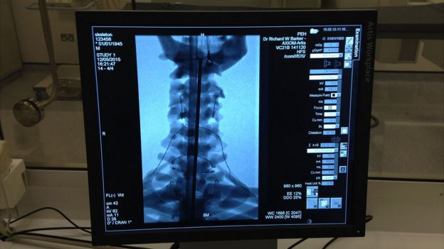 Guernsey health chief Carol Tozer quits after damning report - BBC News