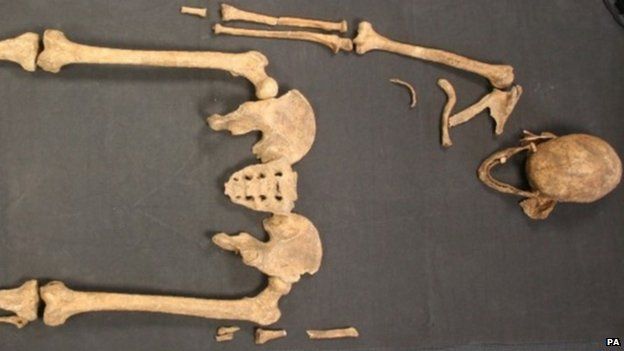 Southampton researchers claim leprosy came to UK from Scandinavia - BBC ...