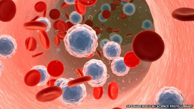 Sleeping cancer cells can 'wake up' decades later - BBC News