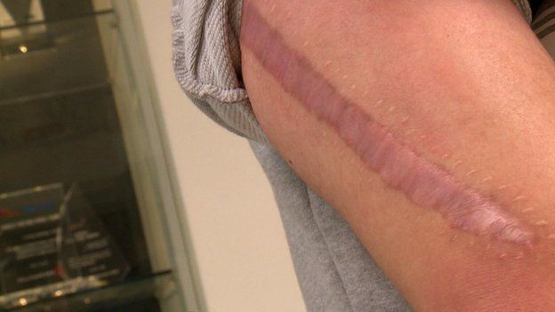 The real scars of Korean gaming - BBC News