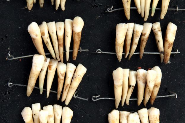 The dentures made from the teeth of dead soldiers at Waterloo - BBC News