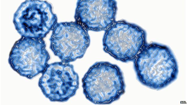 Common cold 'prefers cold noses' - BBC News