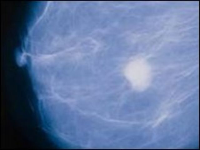 ¿Tratamientos innecesarios? - BBC News Mundo