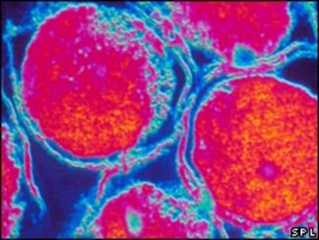 Nuevo diagnóstico rápido de la clamidia - BBC News Mundo