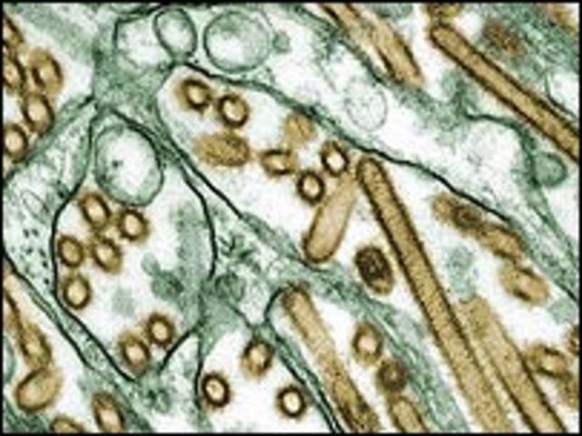 ¿Qué es la peste neumónica? - BBC News Mundo
