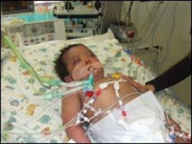 Menino britânico sobrevive a duas leucemias e três transplantes - BBC ...