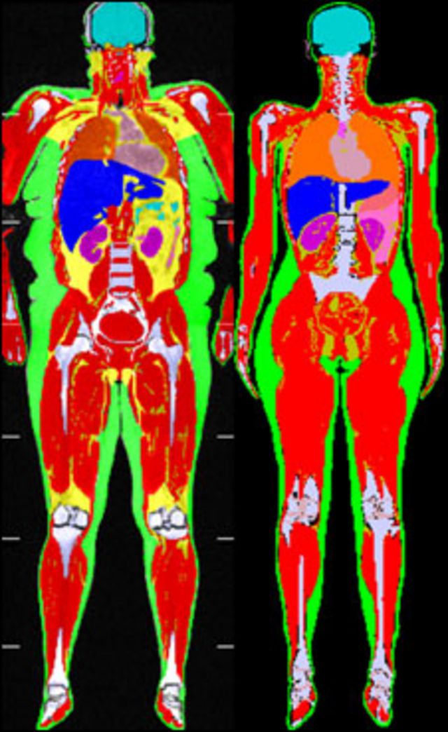 Aparelho ajuda cientistas a 'enxergar' gordura dentro do corpo - BBC ...