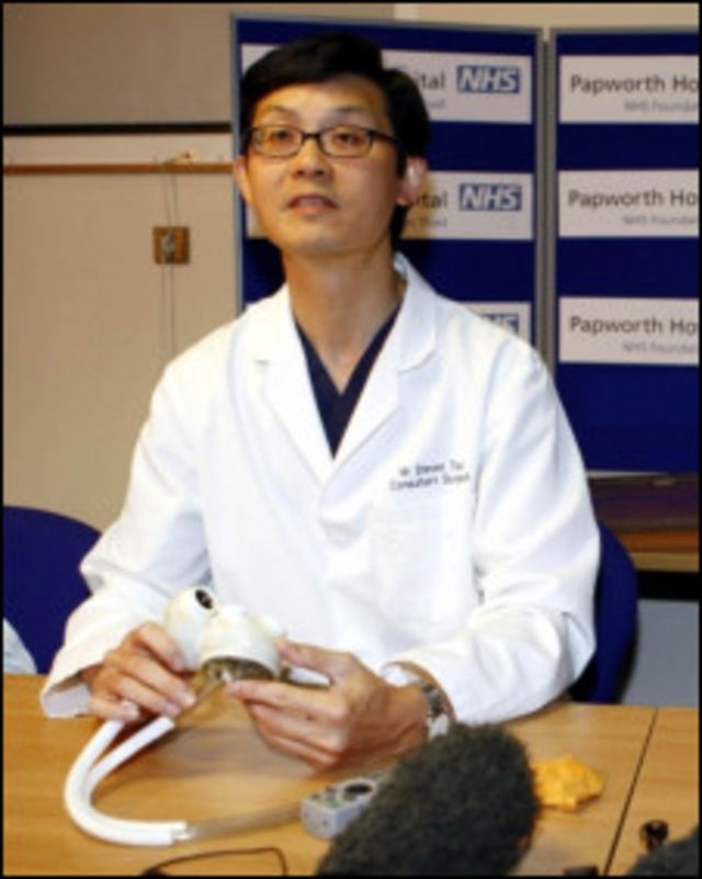 英华人医师成功移植人造心脏 - BBC 英伦网
