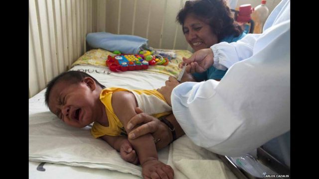 En fotos: La enfermedad que deja su marca en miles de niños - BBC News ...