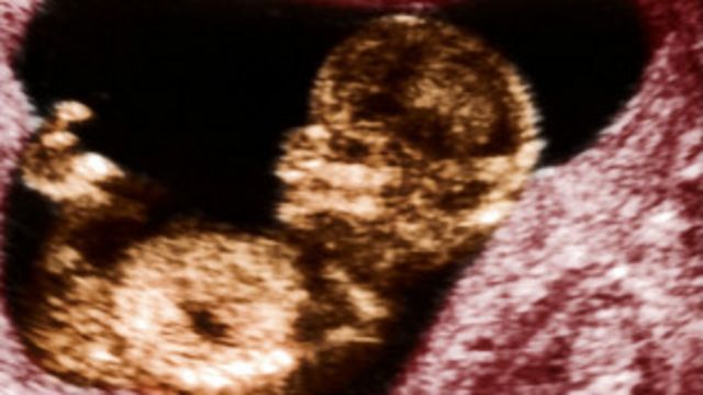 Niña chilena reactiva debate sobre el embarazo infantil - BBC News Mundo