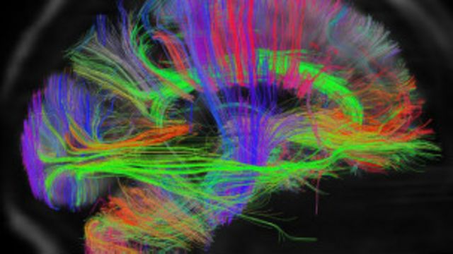 Cómo armar un cerebro - BBC News Mundo