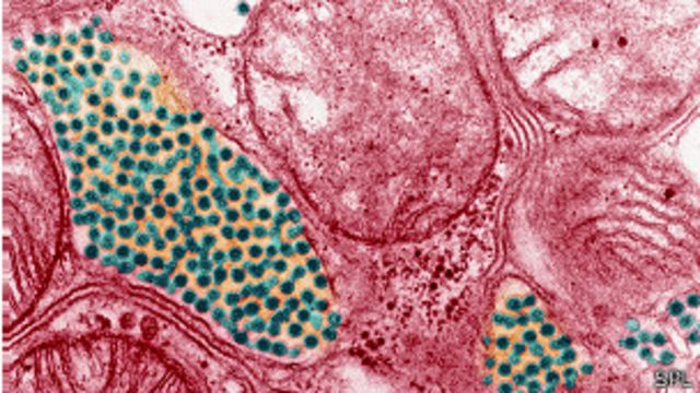 El raro caso del doble virus de encefalitis equina en Panamá - BBC News ...