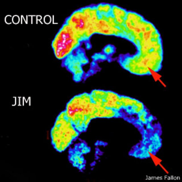 James Fallon, el científico que lleva un asesino dentro - BBC News Mundo