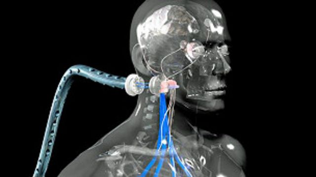 ¿Quién es el verdadero dueño del cuerpo de un cyborg? - BBC News Mundo