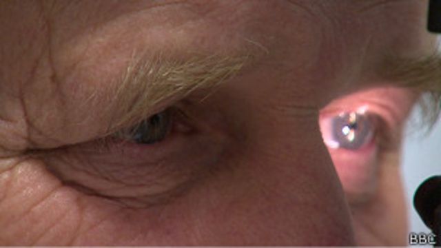 Curan ceguera parcial con terapia de genes - BBC News Mundo