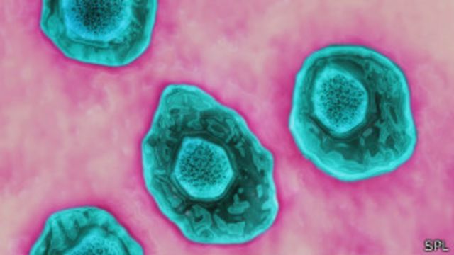 Cómo se descubrió al responsable de la enfermedad del beso - BBC News Mundo